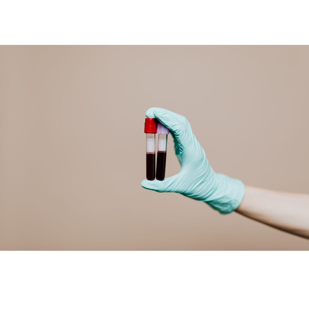 Phlebotomy Technician Program | CDE Career Institute